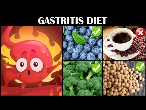 Descarga Gratis Nuestro PDF Con La Mejor Dieta Para Aliviar La ...
