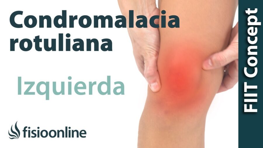 Condromalacia Rotuliana - Ignesistraining.com