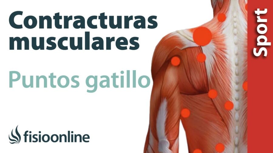 Contracturas Musculares De Espalda - Ignesistraining.com