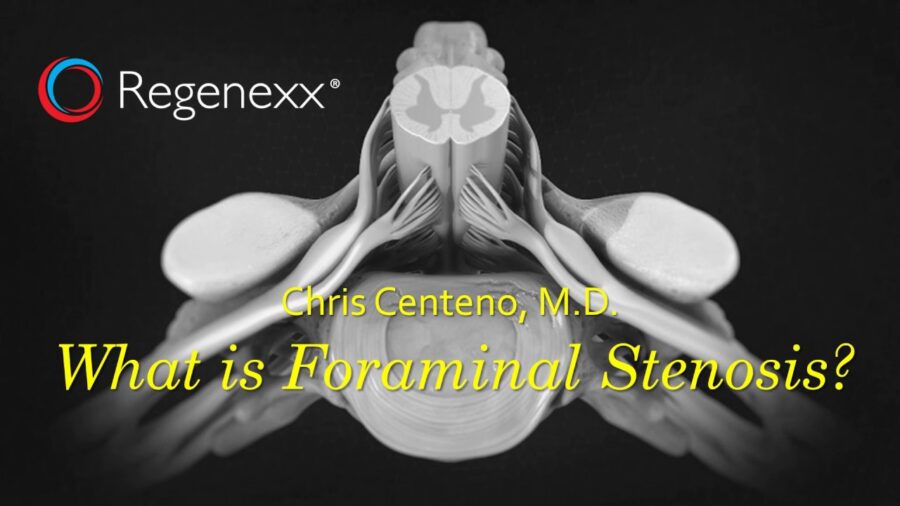Estenosis Foraminal - Ignesistraining.com