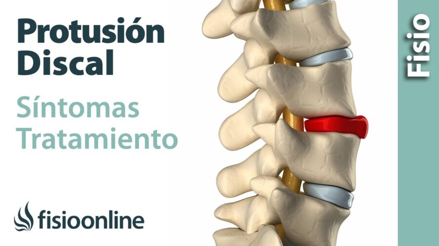 Protrusión Discal Lumbar - Ignesistraining.com